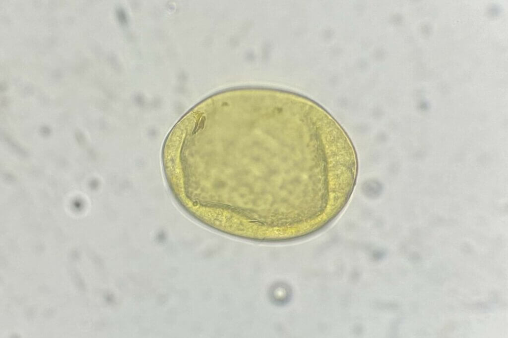 Best practices to manage Fluke | Micron Agritech