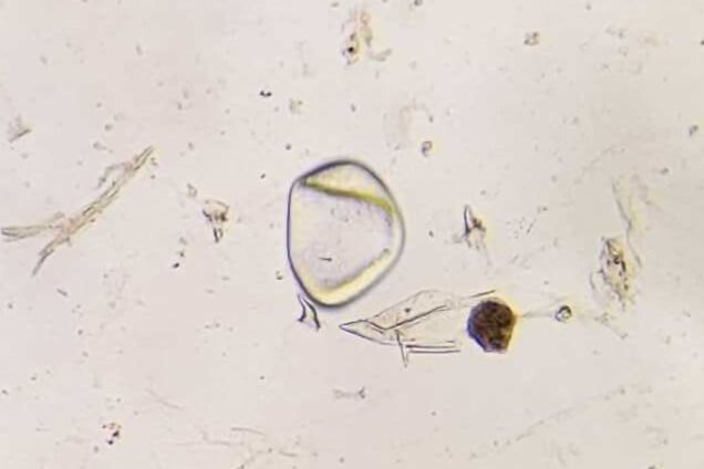 Best practices to manage Fluke | Micron Agritech