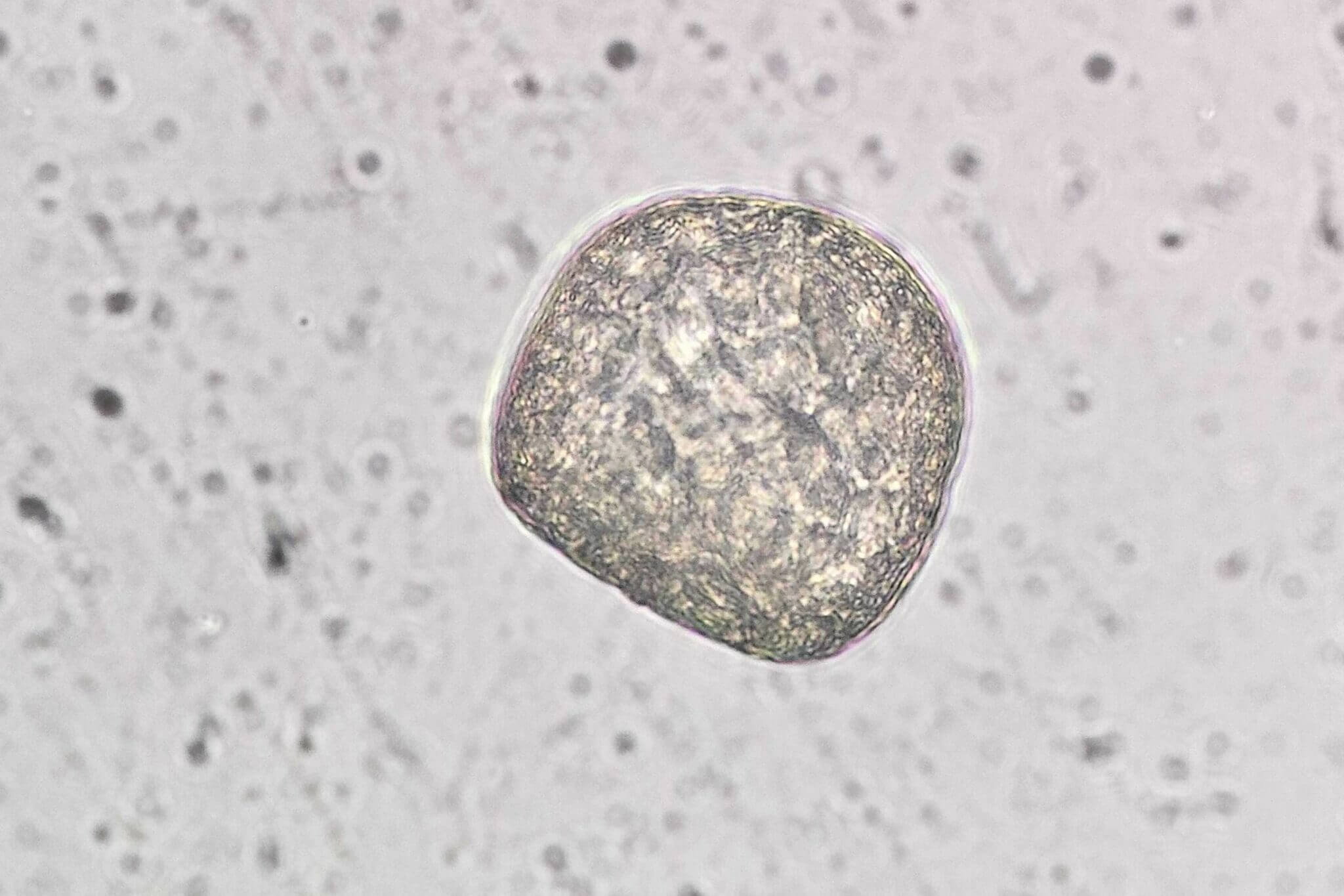 Understanding your faecal egg count worm results | Micron Agritech