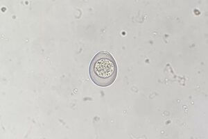 Understanding your faecal egg count worm results | Micron Agritech