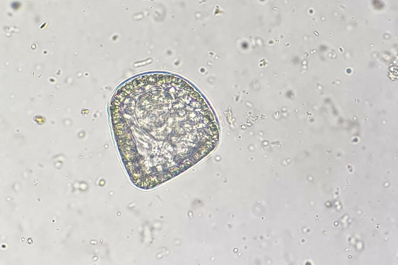 Understanding your faecal egg count worm results | Micron Agritech
