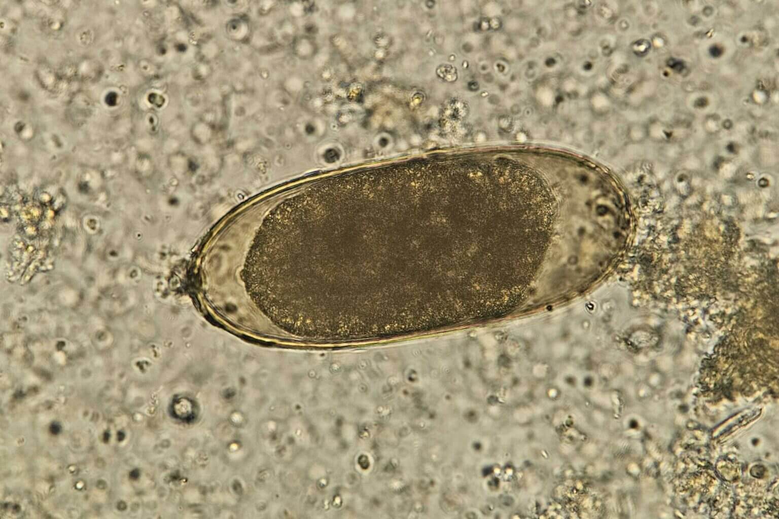 Understanding your faecal egg count worm results | Micron Agritech