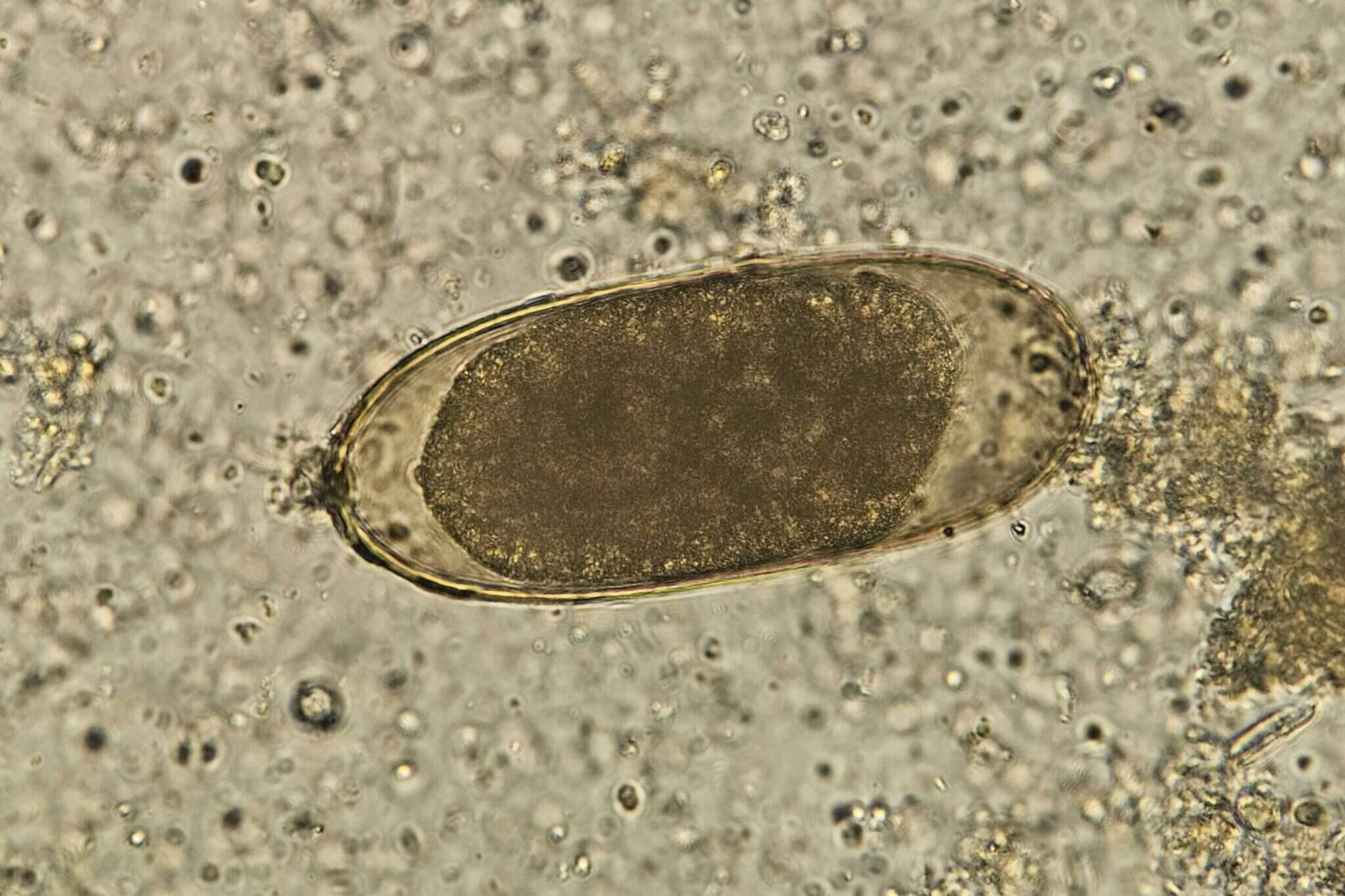 Understanding your faecal egg count worm results | Micron Agritech