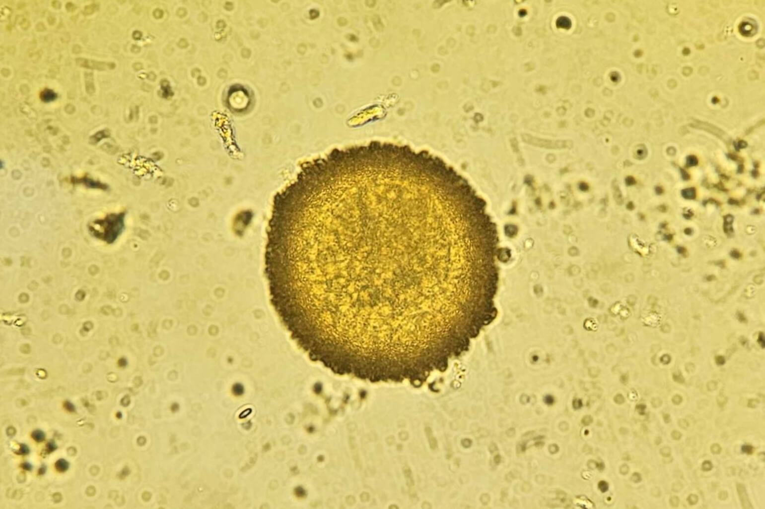 Understanding your faecal egg count worm results | Micron Agritech