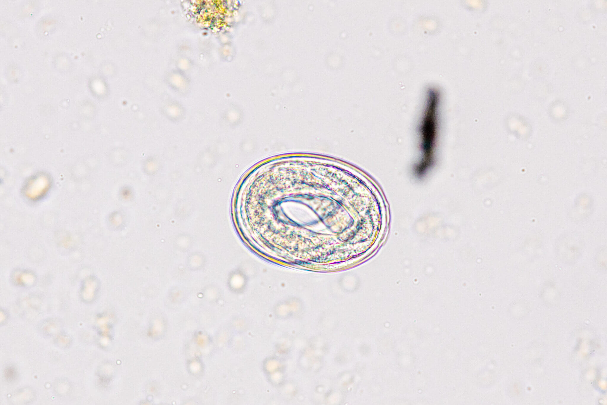 Understanding your faecal egg count worm results | Micron Agritech