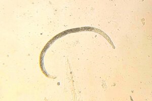 Under the Microscope: Common Large Animal Parasites in Europe | Micron ...